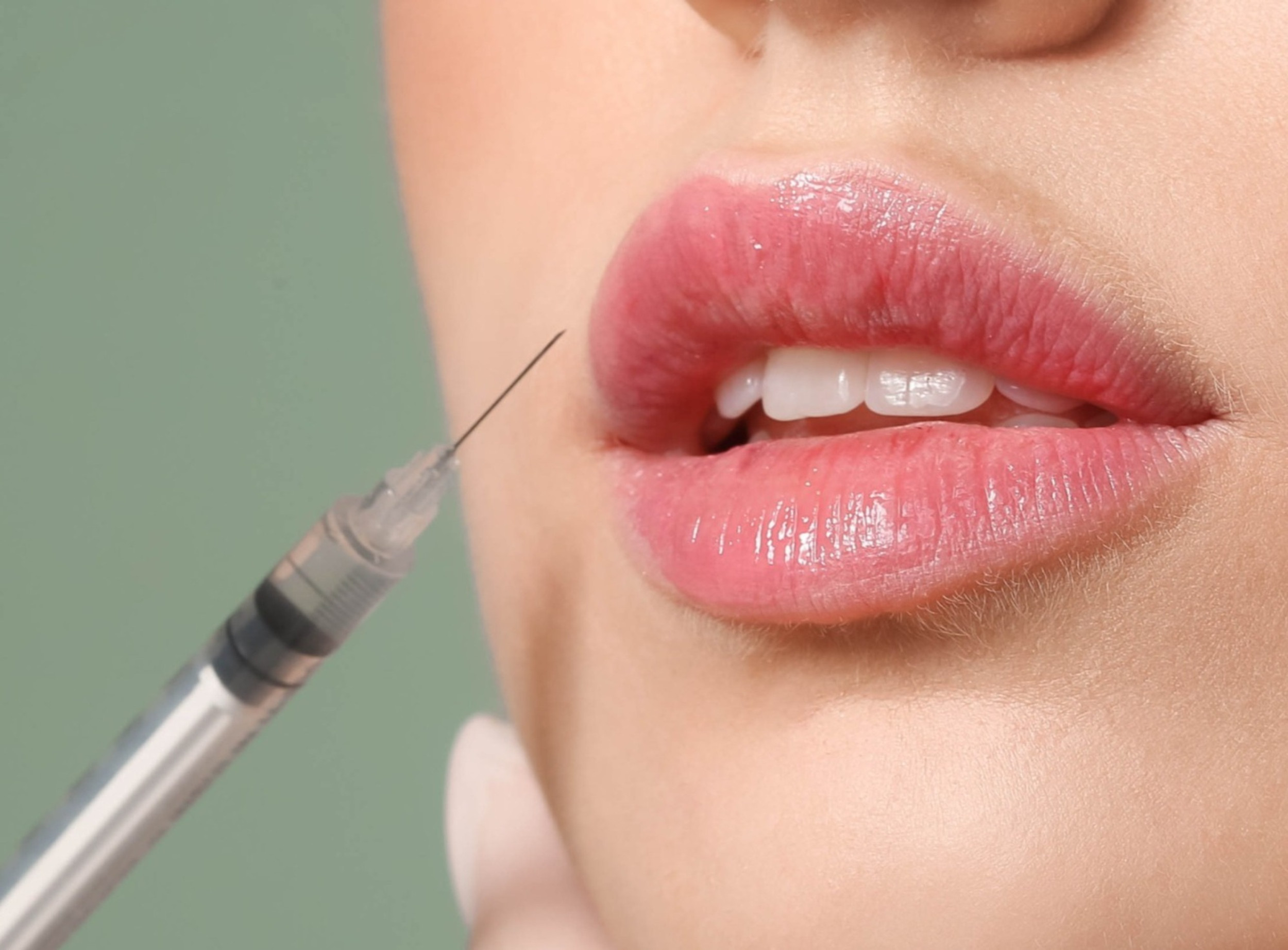 Fillerbehandlinger i Bergen | Best Beauty Klinikk