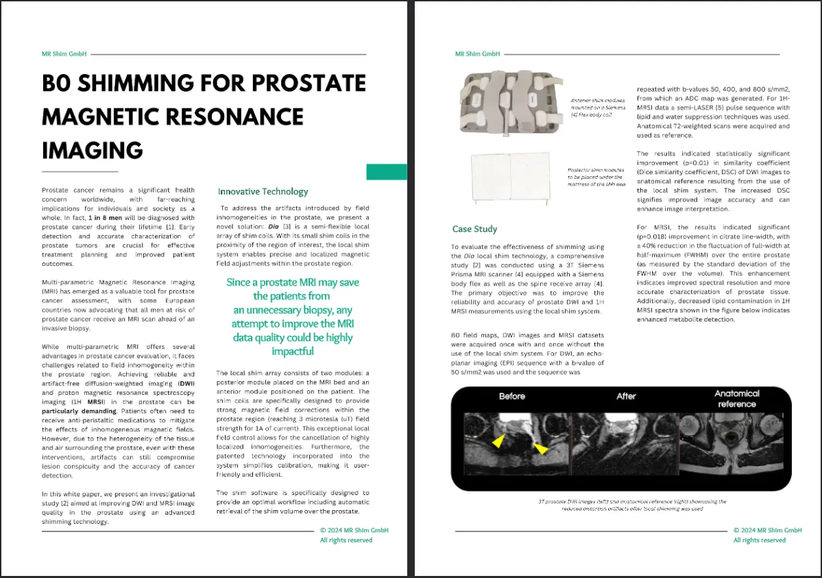 MR Shim | mri shimming