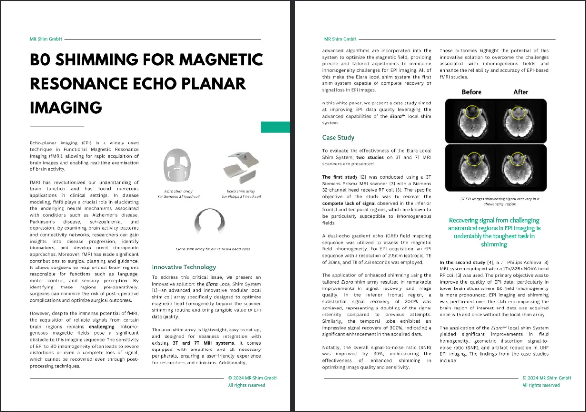 MR Shim | mri shimming