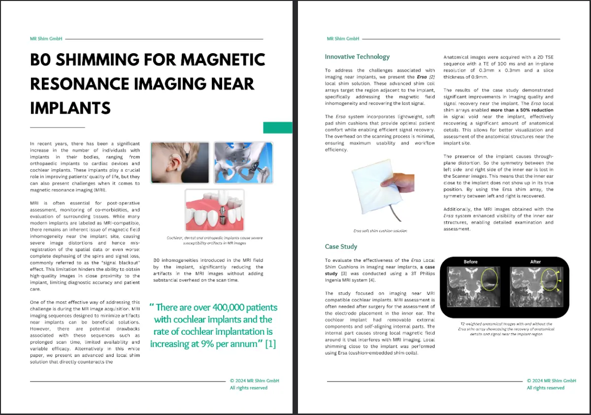 MR Shim | mri shimming