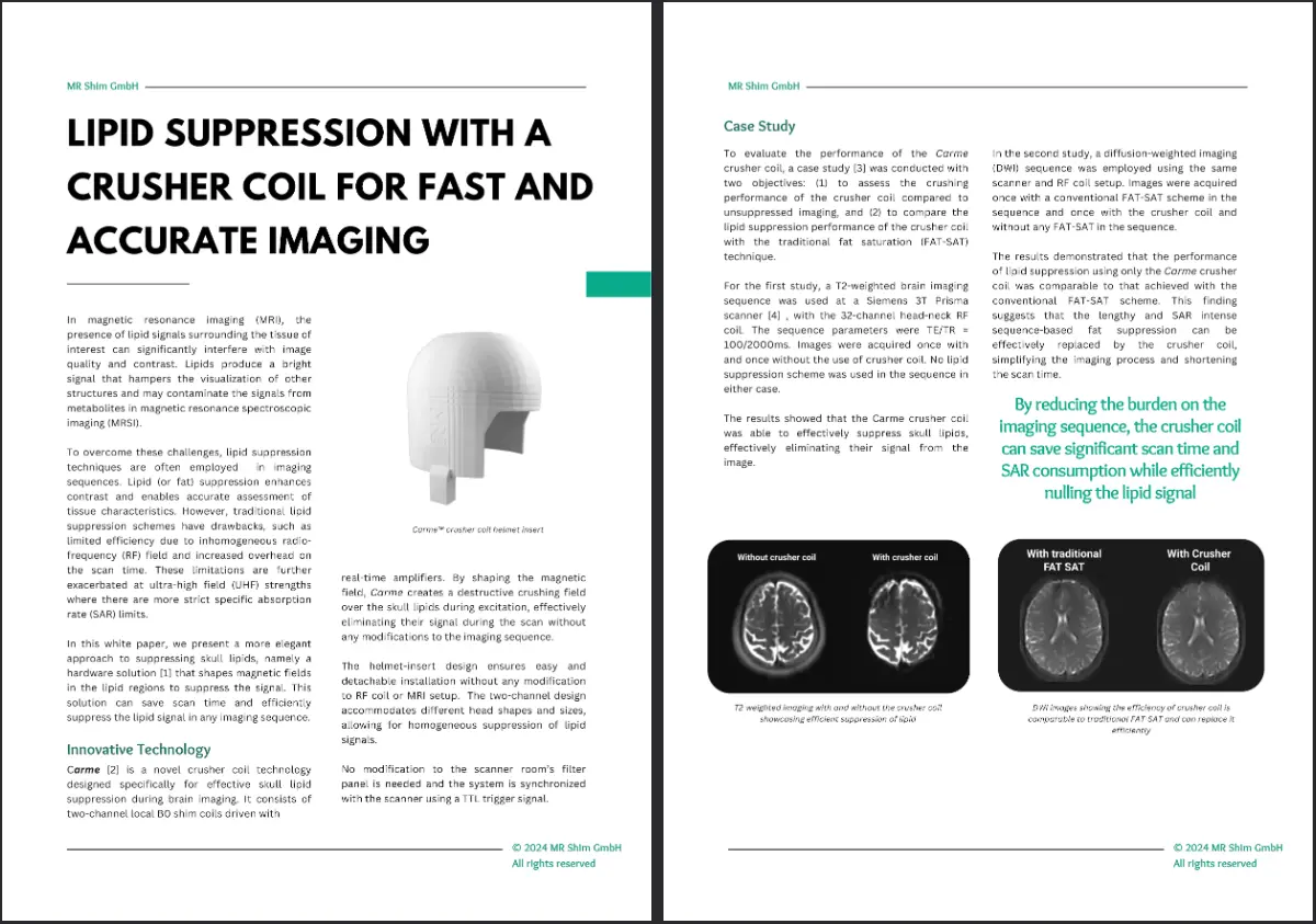 MR Shim | mri shimming