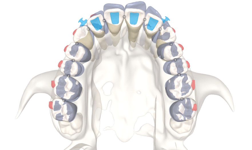Free Aligner case selection by Dentists | 24-Hour Clinical Feedback