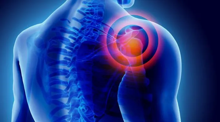Epidural Blood Patch | Premier