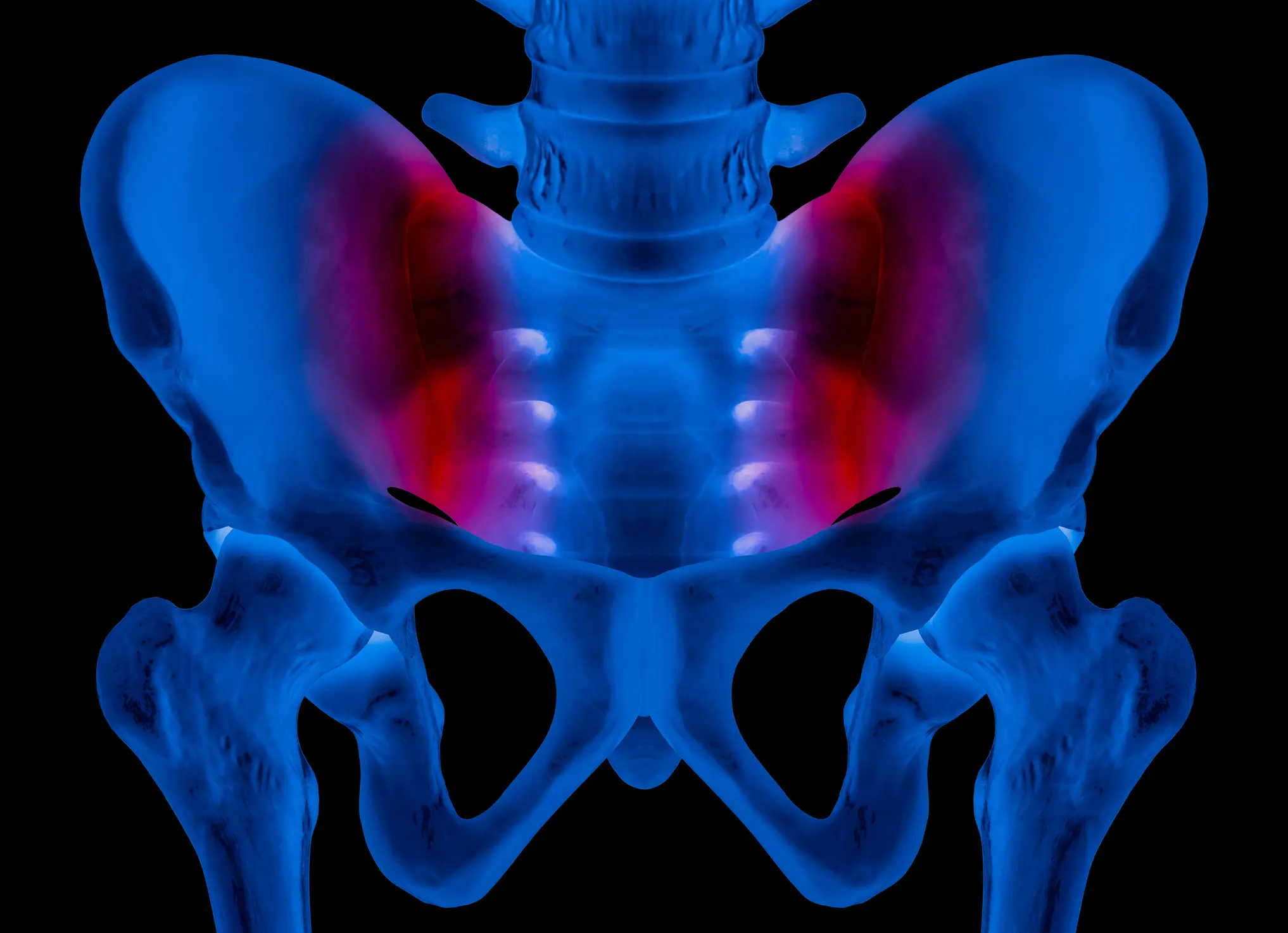Sacroiliac Joint Injection | Premier