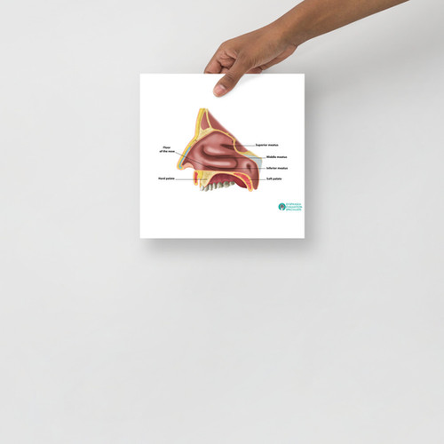 Meatus Photo paper poster | Dysphagia-FEES