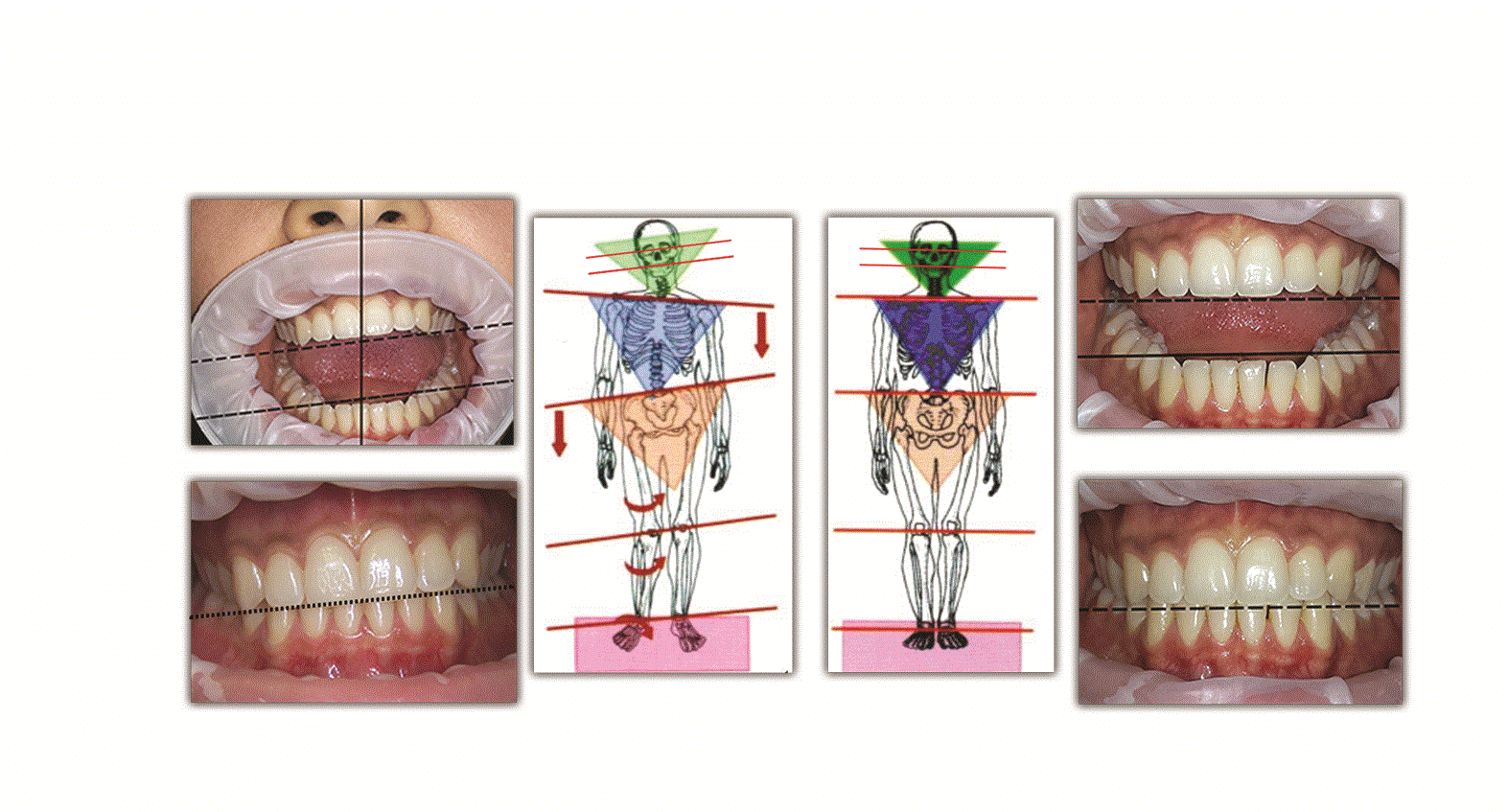 AMCOP CLASS 3 - 45-65mm Green | OrthoFlex