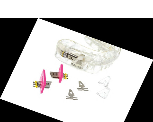 TWIN WING CLASS II CORRECTOR KIT | OrthoFlex