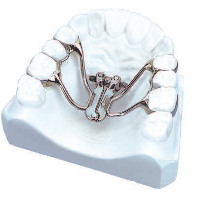 FAN-TYPE RAGNO RAPID EXPANDER AND MINI RAPID EXPANDER(patented ...