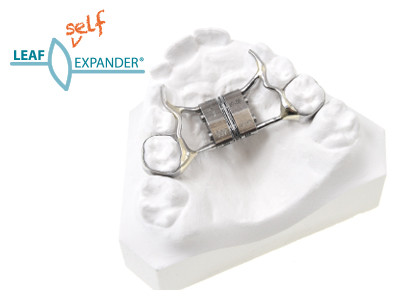 MEMORIA® Leaf Spring Self-activated expander | OrthoFlex