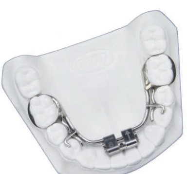 RPE Leone EXPANDER FOR LOWER ARCH 8-11mm Torko | OrthoFlex