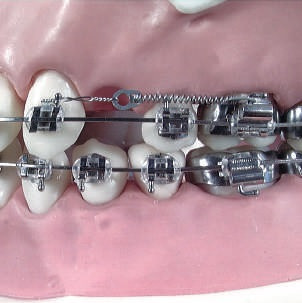 MEMORIA® CLOSED COIL SPRING WITH WOUND ENDS AND LIGATURE WIRE | OrthoFlex