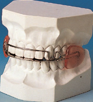 BITE PLANES FOR FUNCTIONAL PLATES | OrthoFlex