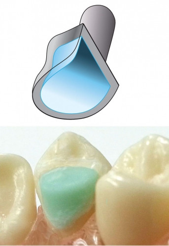 MINI MOLD CUSPID BITE RAMP adult | OrthoFlex