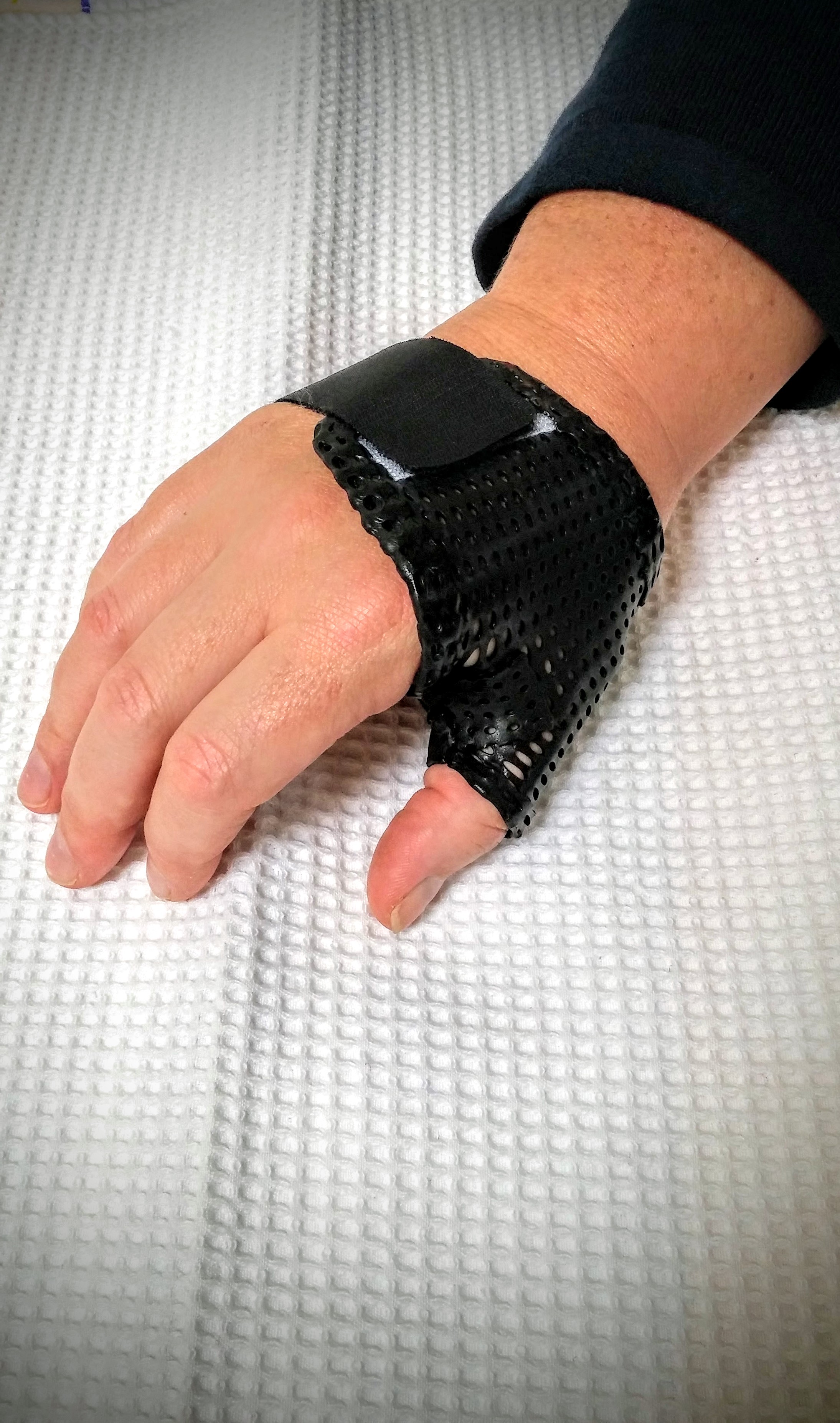 ATTELLE DE MAIN thermoformée, rhizarthose, arthrose,