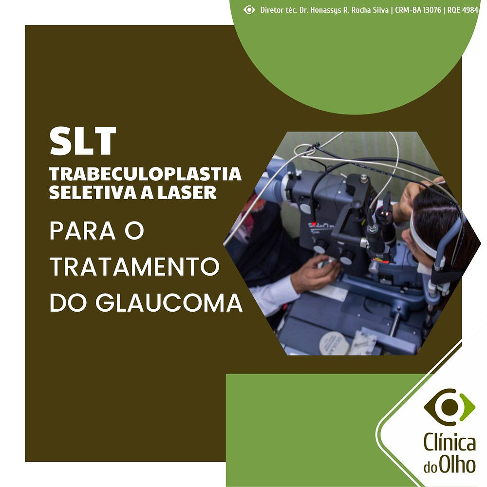 SLT (Trabeculoplastia Seletiva a Laser) para tratamento de glaucoma