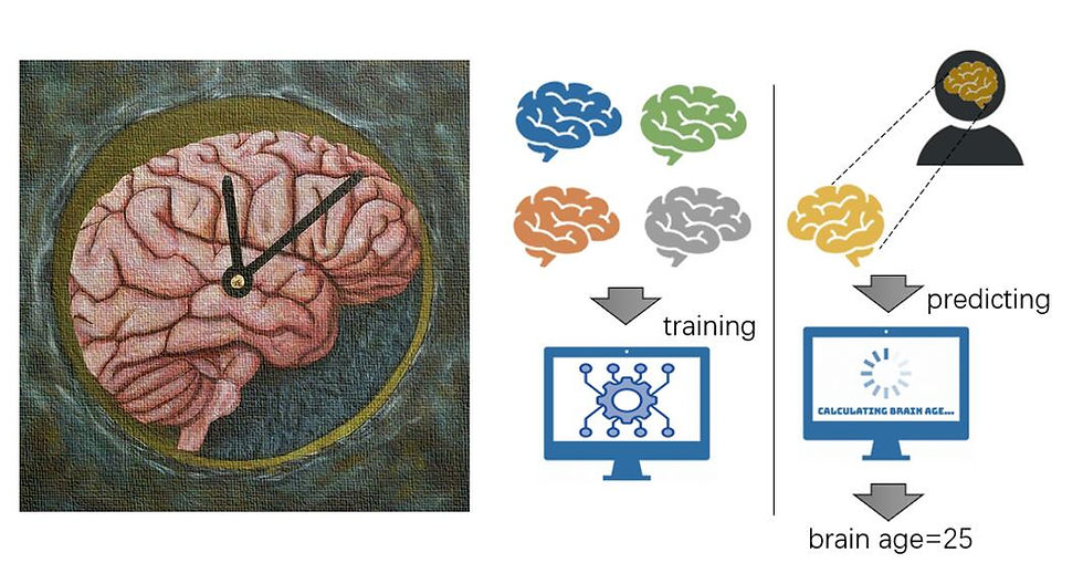 Advancement in Brain-Age Estimation: The Largest Study on Brain Age ...