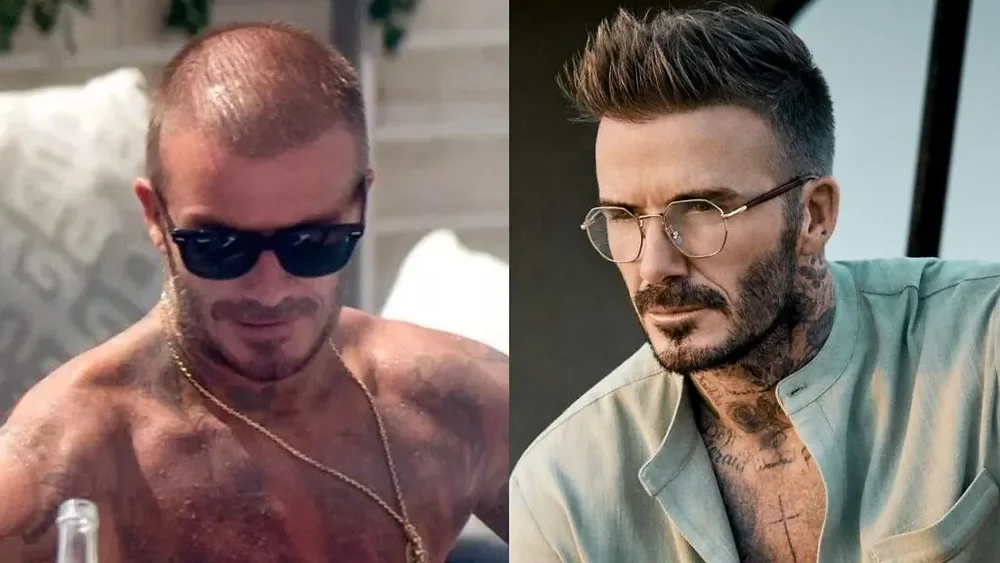 David Beckham’s Hair Journey: From Balding to a Fuller Look