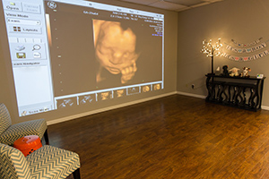 Hey Baby 4d Ultrasound Wexford, PA Gender Reveal