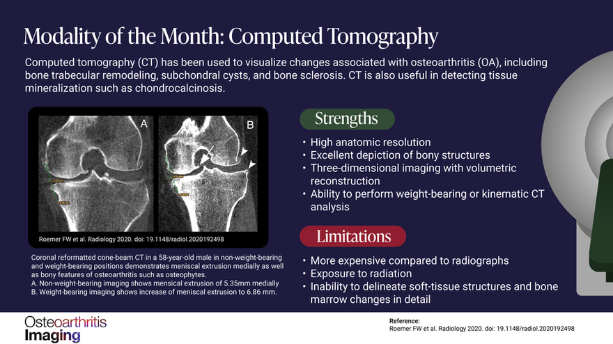 Modality of the Month | isoai
