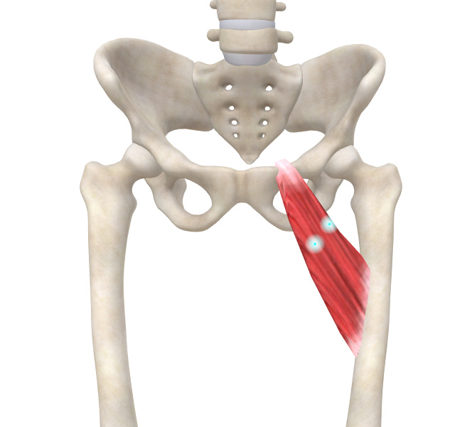 TRIGGER POINT OF THE WEEK – ADDUCTOR LONGUS