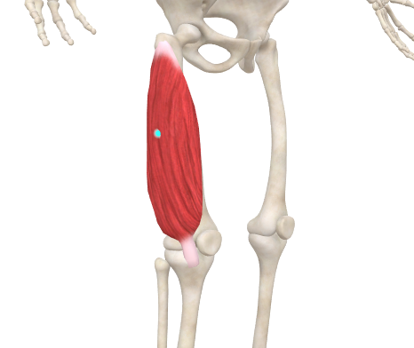 TRIGGER POINT OF THE WEEK - VASTUS LATERALIS