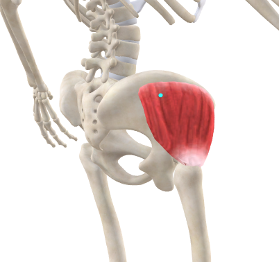 TRIGGER POINT OF THE WEEK – GLUTEUS MEDIUS