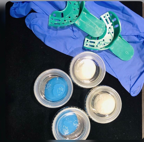 Molding Kit | Essential Grillz