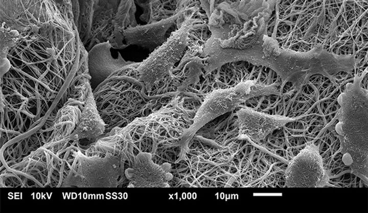 Fascia and Movement: What You Need to Know!