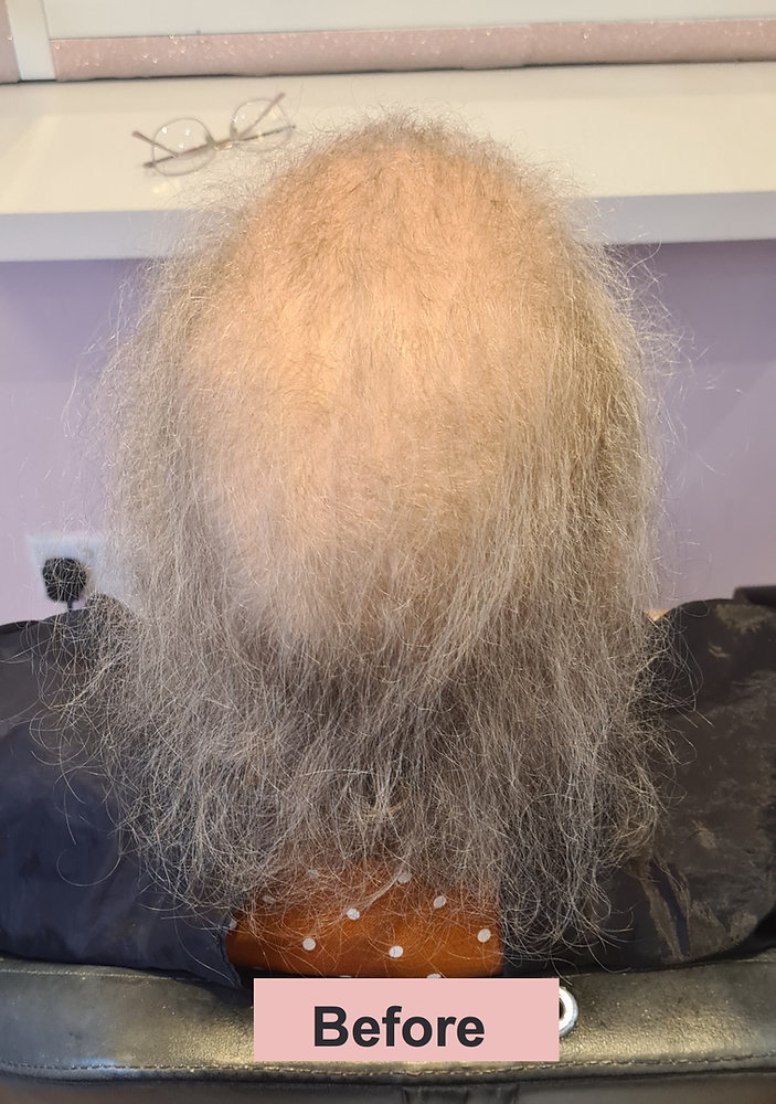 Hair Extensions for Hair Loss