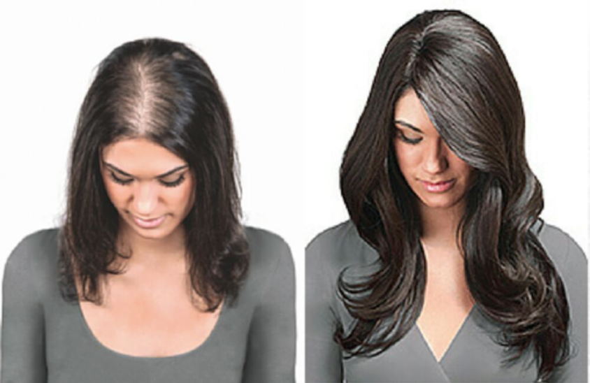 Hair Integration & Hair Loss Systems | BEAUTIQUE