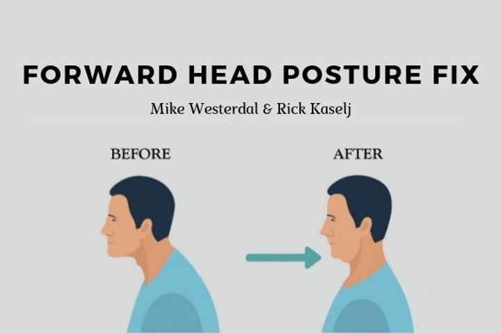 Forward Head Posture FIX Review - Fact or Fiction?