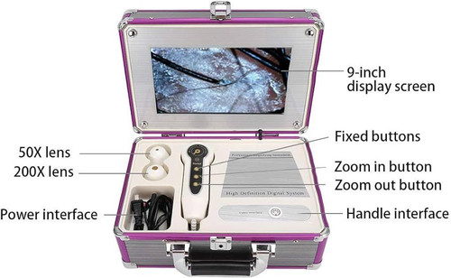 Scalp Scanner | Scalp Vista