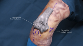 SURGICAL GUIDANCE | World Surgery Tour