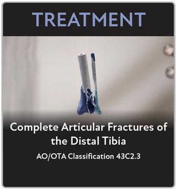 Foot & Ankle | World Surgery Tour