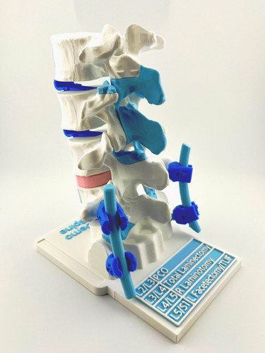 Anatomical lumbar model for medical students and surgeons: L2-S1 Spine ...