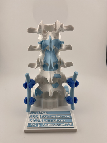 Anatomical lumbar model for medical students and surgeons: L2-S1 Spine ...