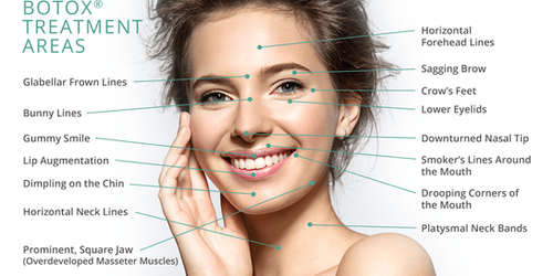 Botox injection 50 units | cosmomedspa