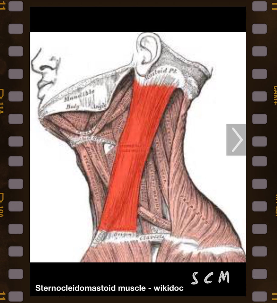 The Sternocleidomastoid