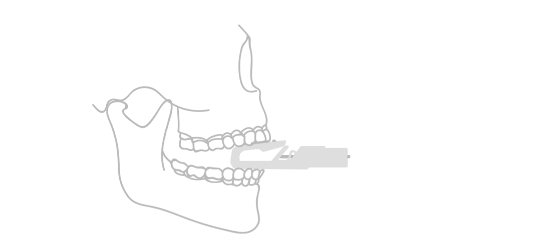 COLIBRI - BITE OPERATED MOUTH STICK FOR PEOPLE WITH DISABILITY