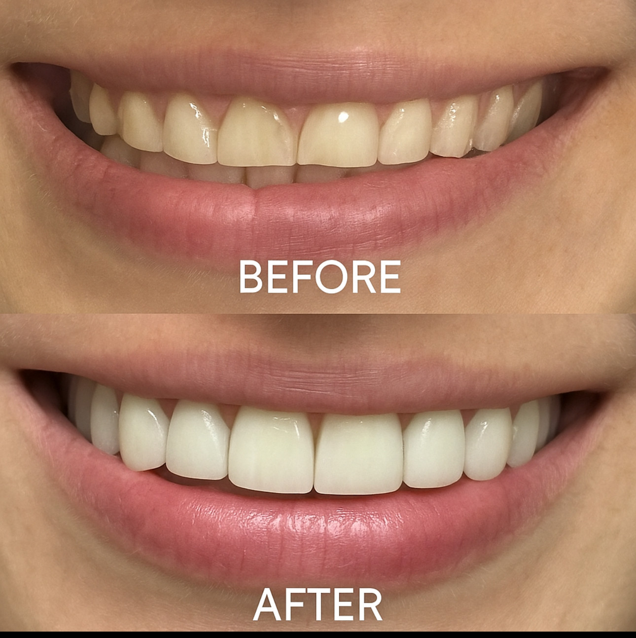 Bioclear: Restoring Smiles from Broken to Beautiful