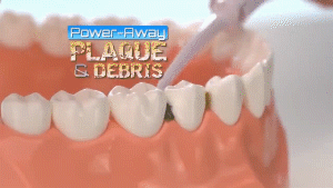 What is the purpose of interdental brushes and water pick in dentistry ...