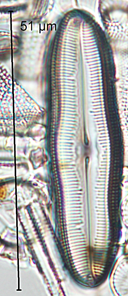 Pinnularia | Mendota Diatoms