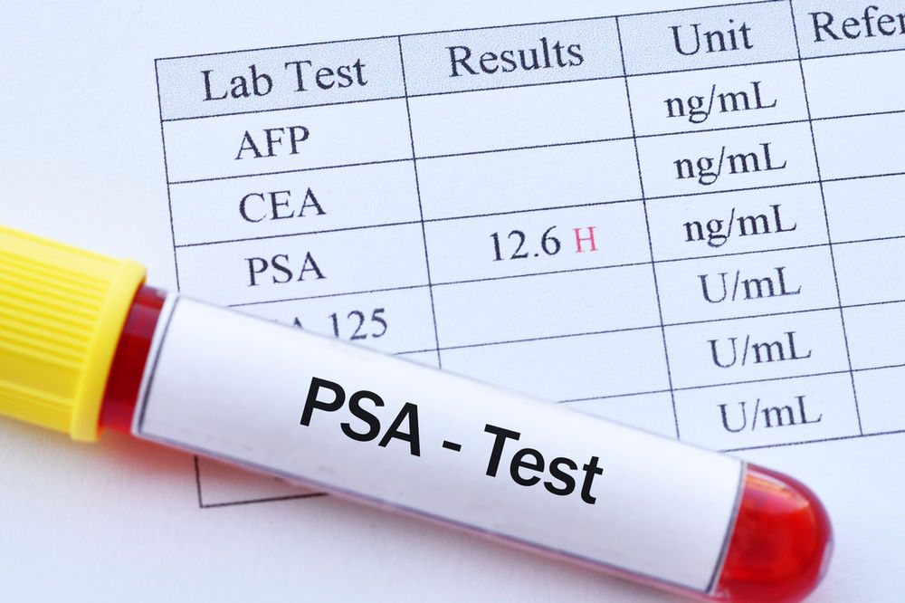 PSA Or Not-to-PSA, That Is The Question!