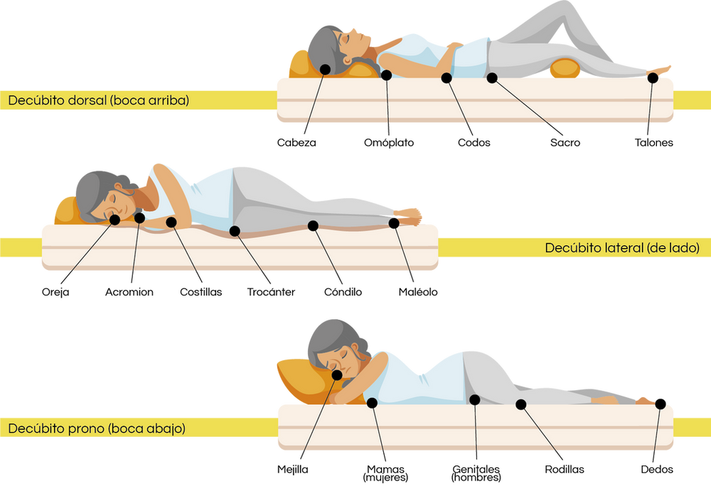 Úlceras por presión: qué son y cómo prevenirlas