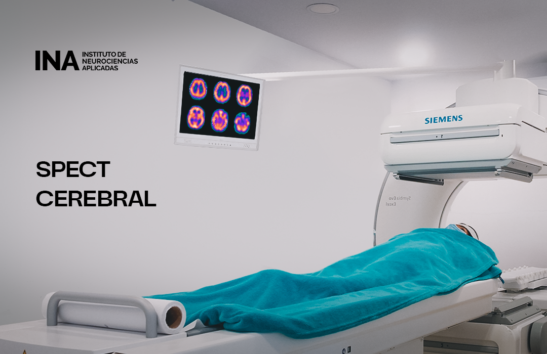 SPECT Cerebral: Diagnóstico Preciso en Trastornos Mentales