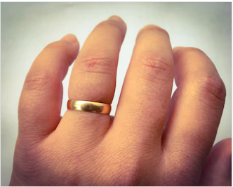 Ring Entrapment and Removal