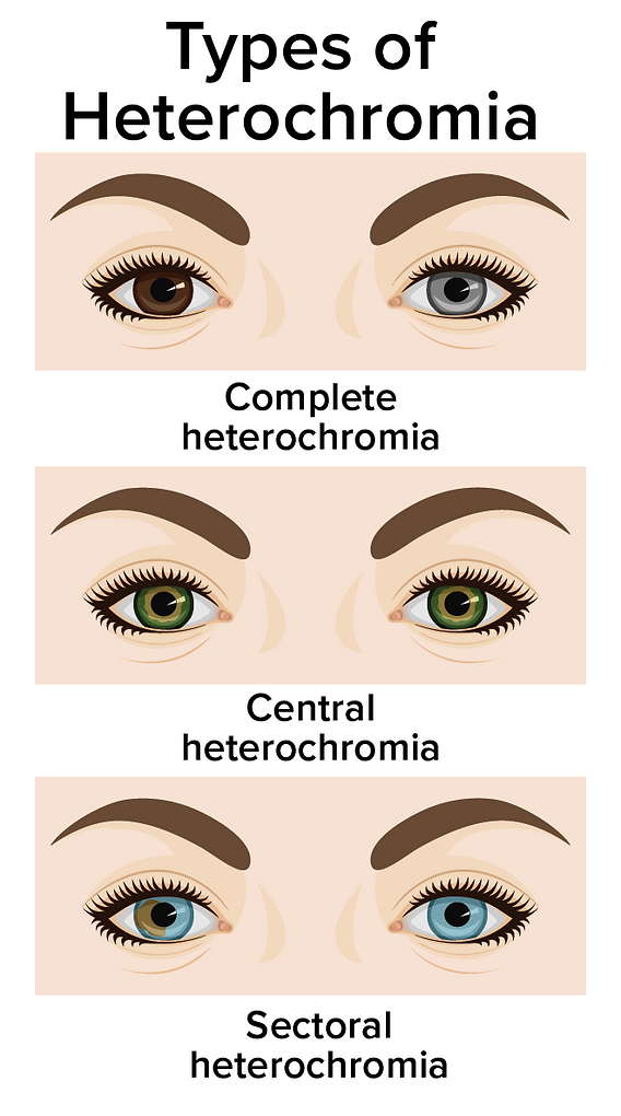 eye mutations
