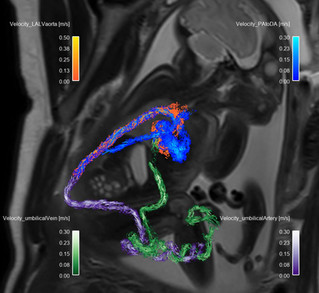 Fetal CMR | Northh Medical