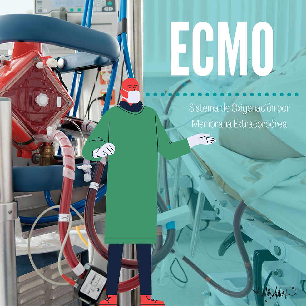 ECMO: Sistema de Oxigenación por Membrana Extracorpórea