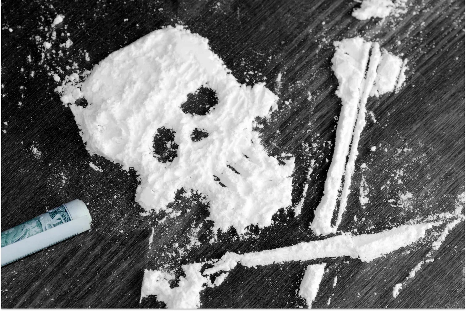 What Does Cocaine Do to Your Brain?